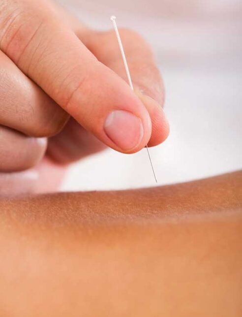 Hot Flashes - Yang Orlando Acupuncture